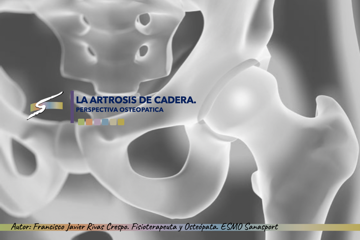 La Artrosis De Cadera En El Contexto De La Consulta De Osteopatia